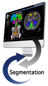 Fovia AI - Artificial Intelligence Cloud-based Medical Imaging