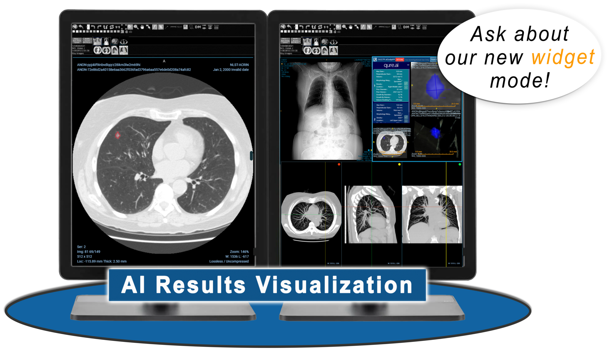 Fovia AI - Artificial Intelligence Cloud-based Medical Imaging